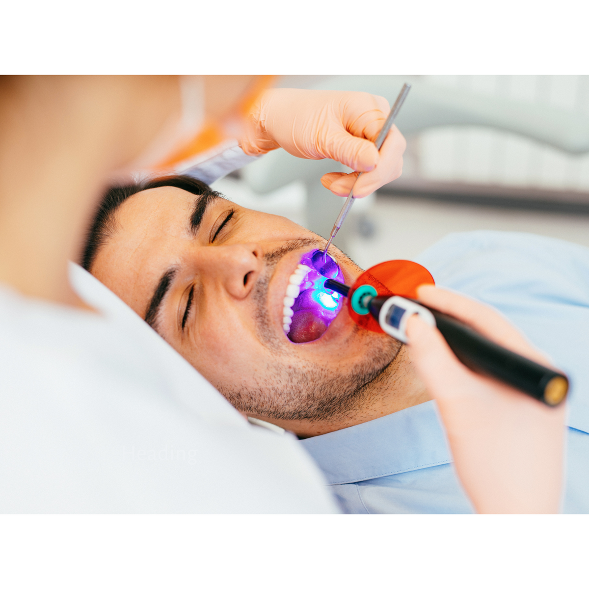 The Importance of Choosing the Right Dental Curing Light for Your Prac ...