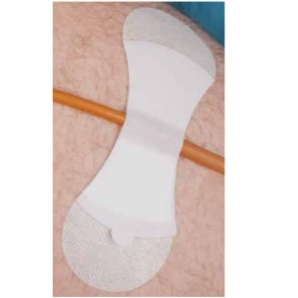 Grip-Lok Universal Securement Device, Sterile for Safe and Reliable ...